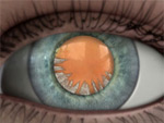 Learn About Cataracts with Stamper Optometry | San Francisco CA
